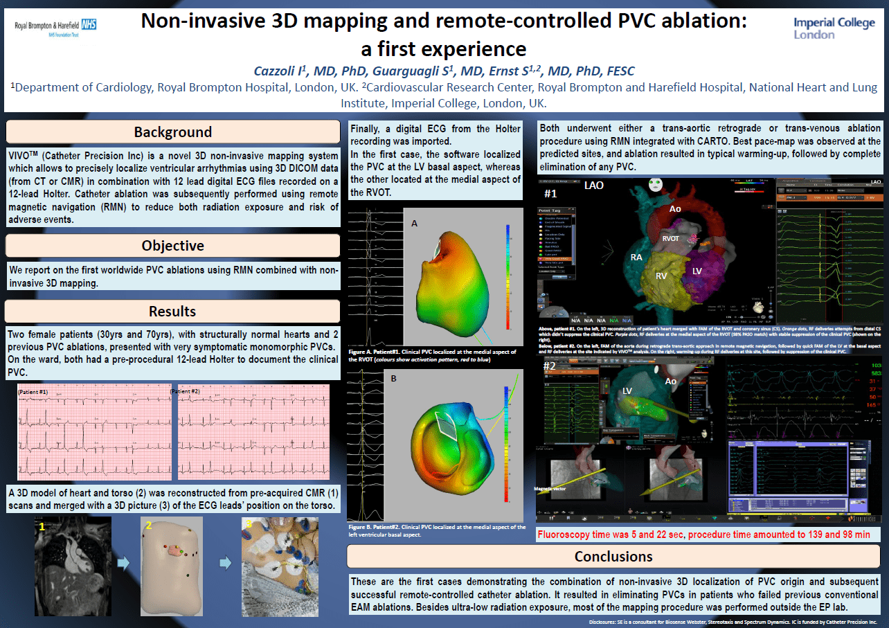 Non-invasive 3D mapping and remote-controlled PVC ablation: A First ...